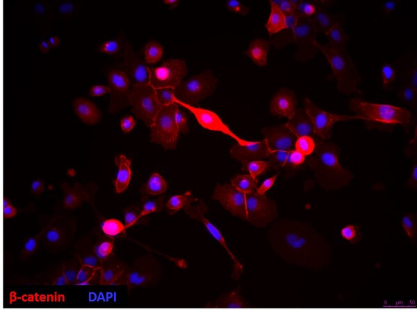 SCC-61 Human Squamous Cell Carcinoma Cell Line | SCC280